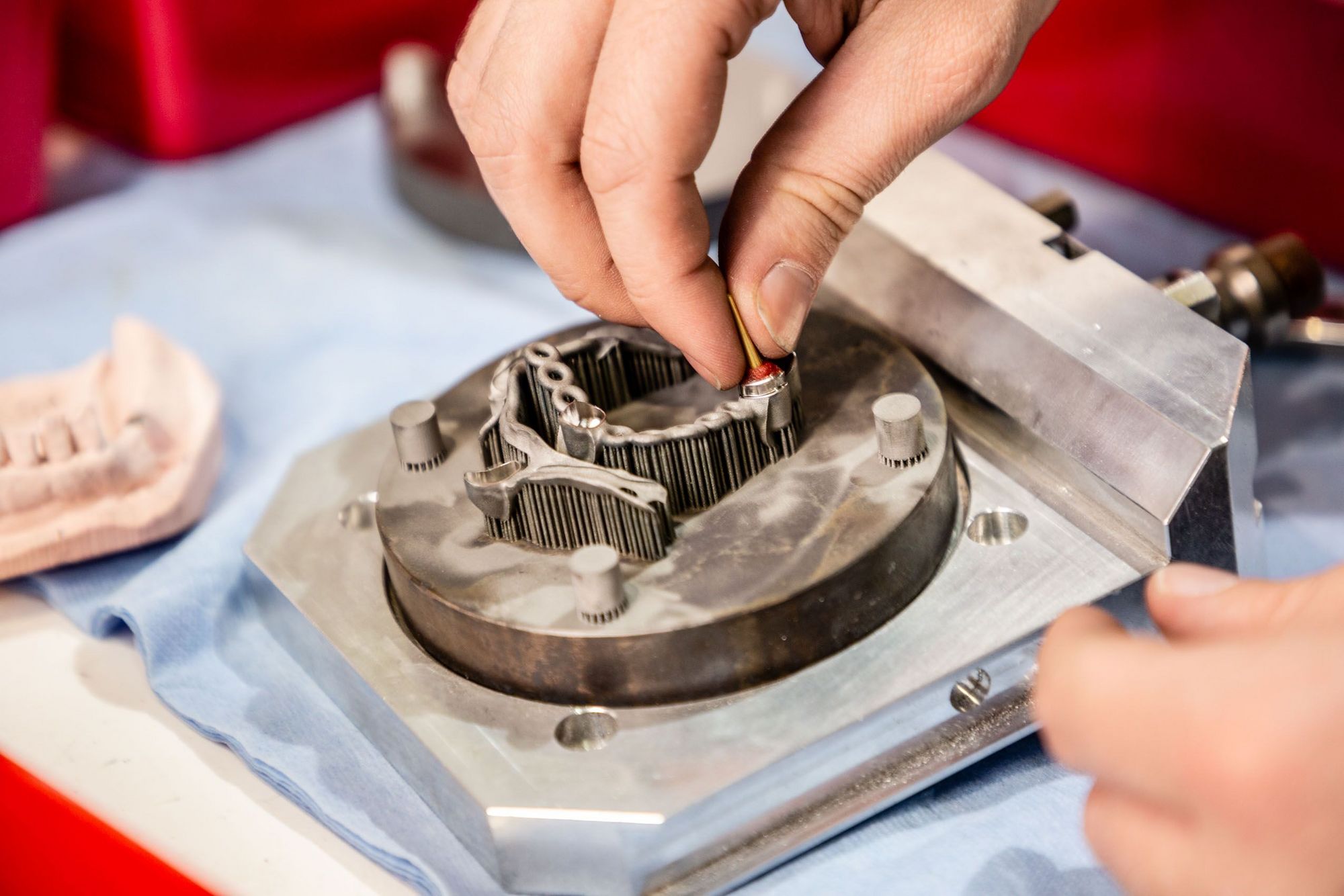 Smart solution for precision-fit dental crowns | TRUMPF