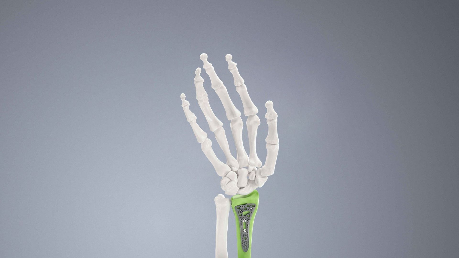 Example parts | TRUMPF